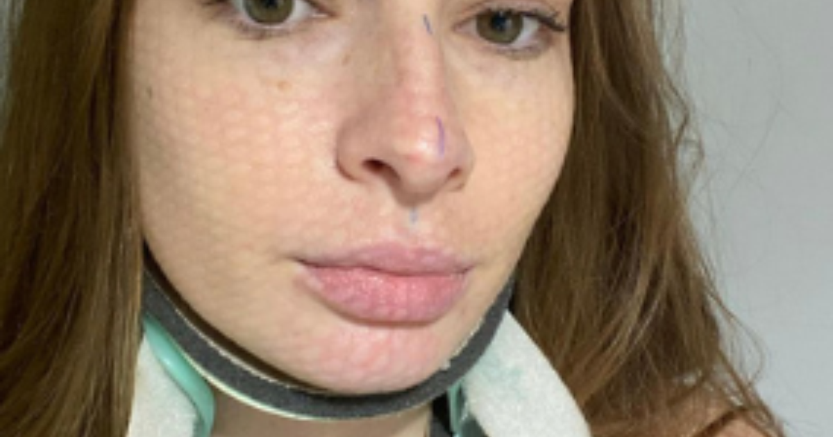 Chordoma Foundation | Kate's Uncommon Story